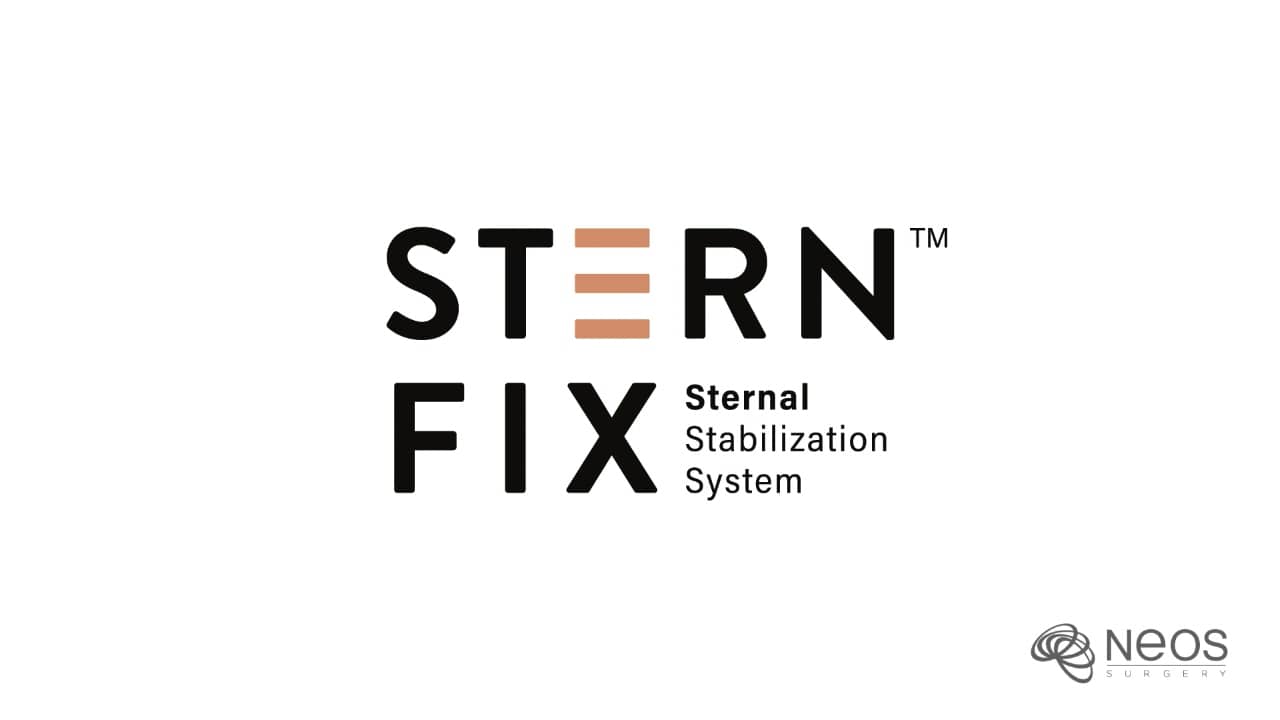 Surgery video STERNFIX sternal stabilization system on Vimeo