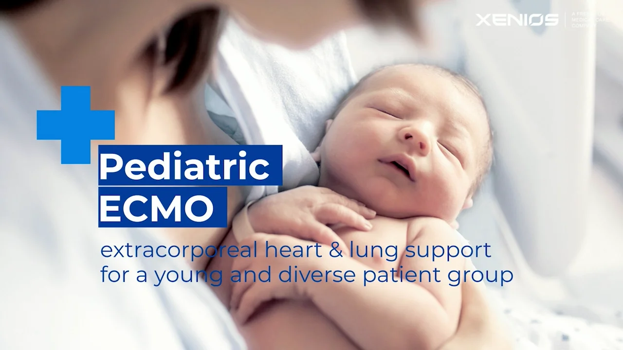 Pediatric ECMO