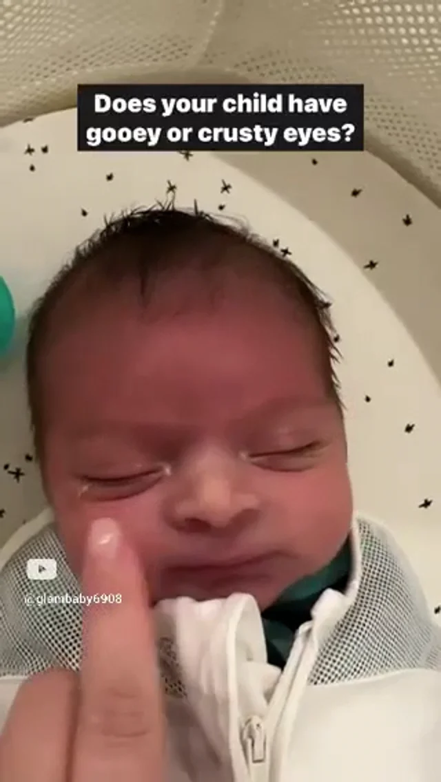 Baby Has Crusty Eye