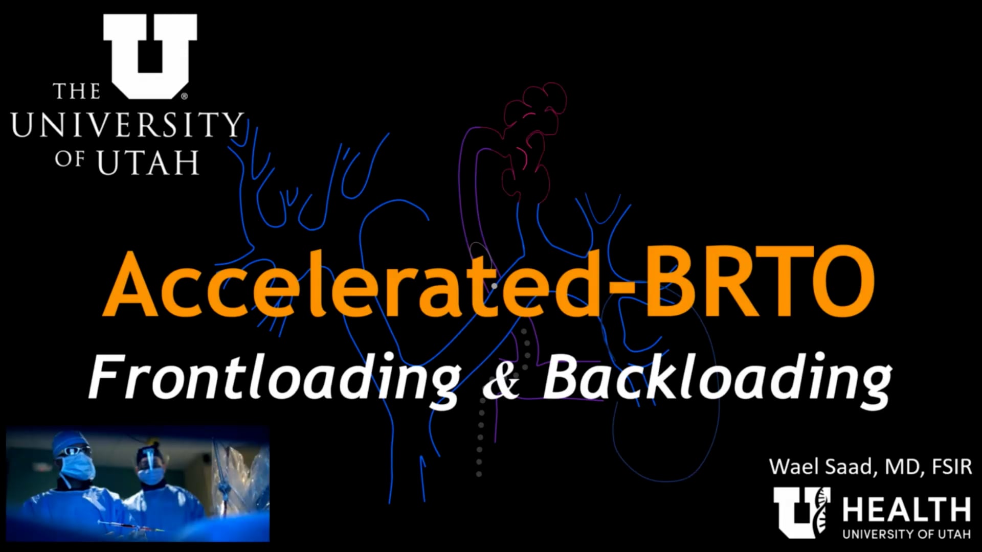Accelerated BRTO Back-loading of hardware -W. Saad (USA) on Vimeo