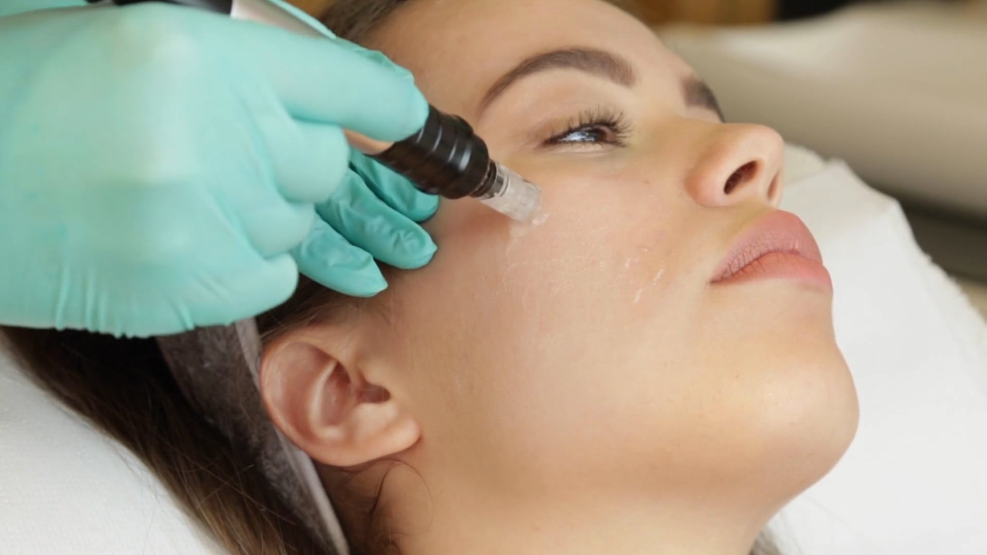 Revitalize Your Skin with Botox Injections