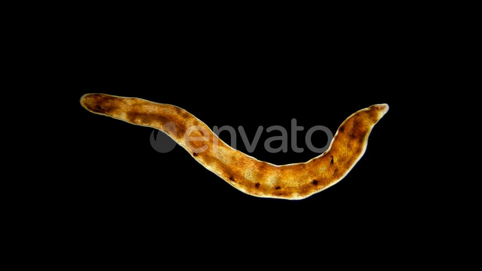 28758058_nemertea-worm-under-a-microscope-supertype-spiralia-highest ...