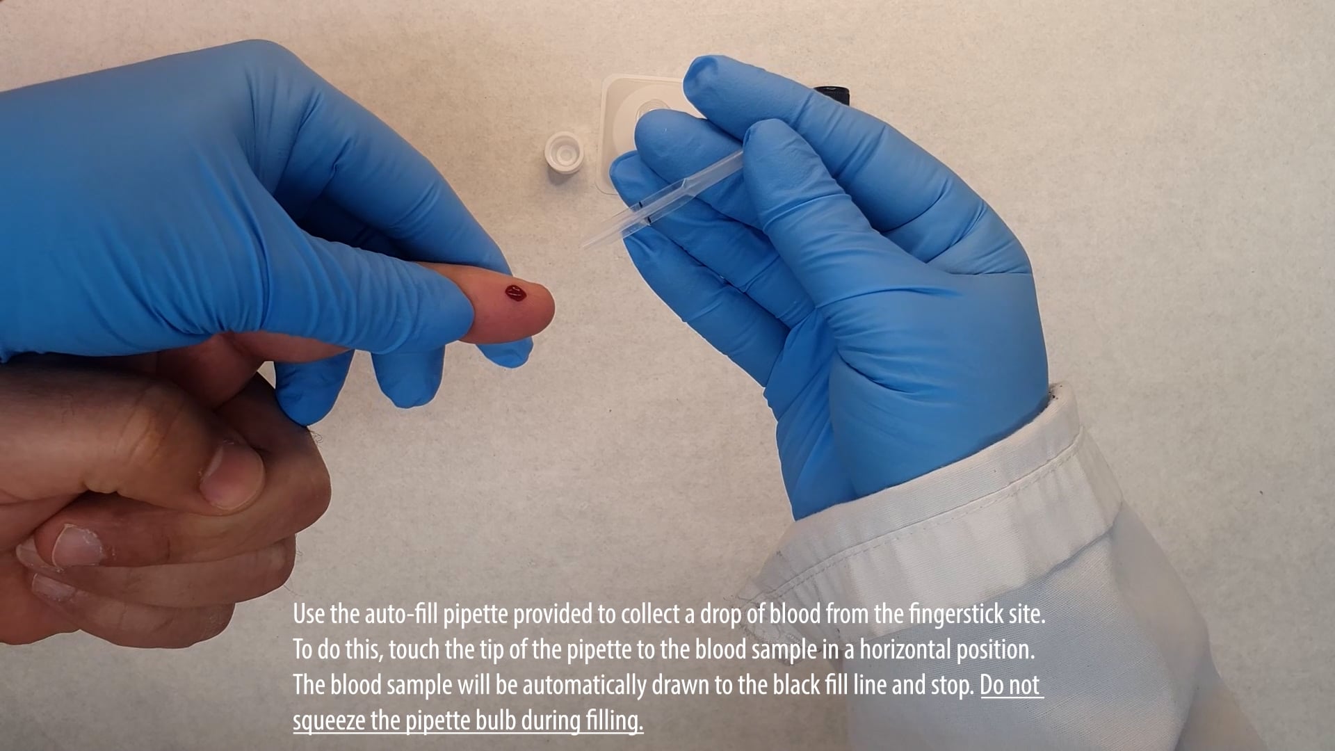 Reveal TP Syphilis -POC Fingerstick Whole Blood02.mp4 on Vimeo