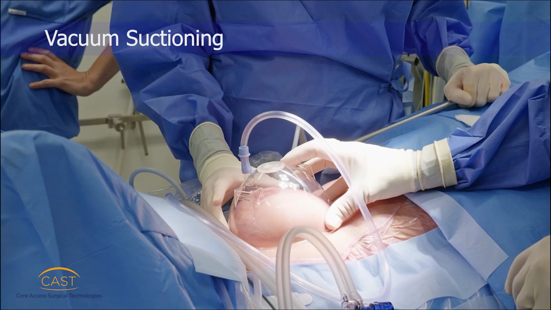 LevaLap 1.0 Final Video 2023