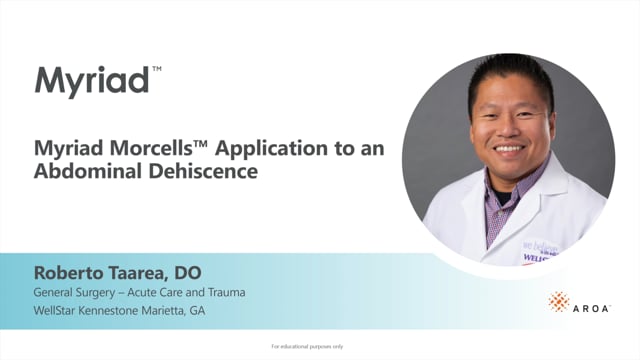 Myriad Morcells™ | AROA