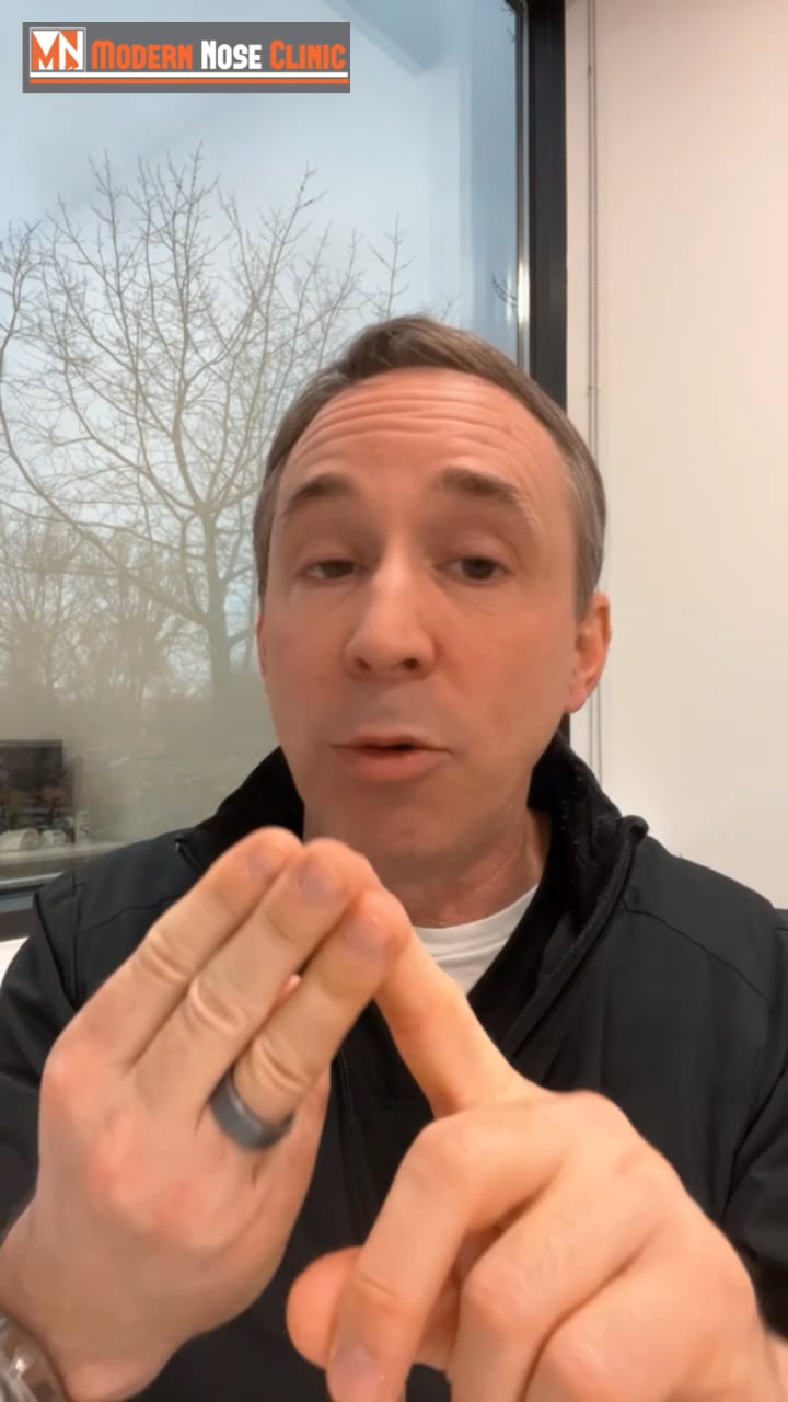 Everything you need to know: Sinusoft Procedure on Vimeo