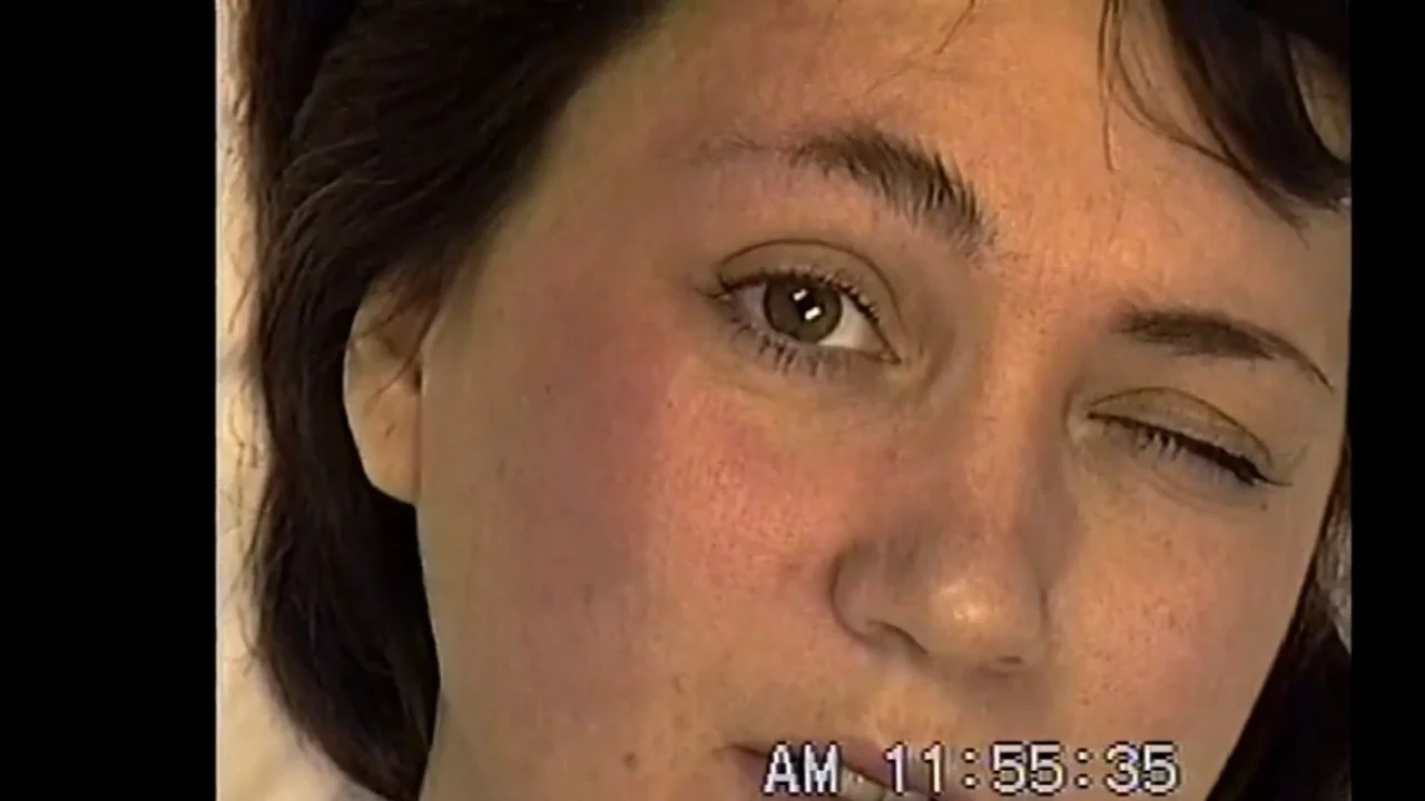 Melva_England_Bell's Palsy 4 yr_DFR Therapy on Vimeo