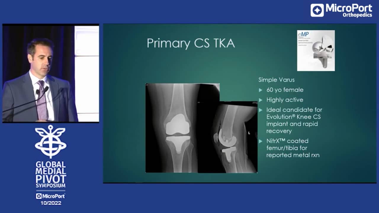 Joseph Assini, MD - Versatility of Medial-Pivot Quest for Joint ...
