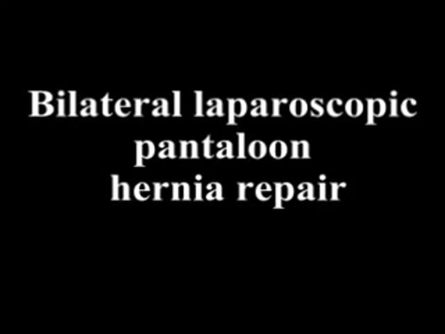 Pantaloon Hernia