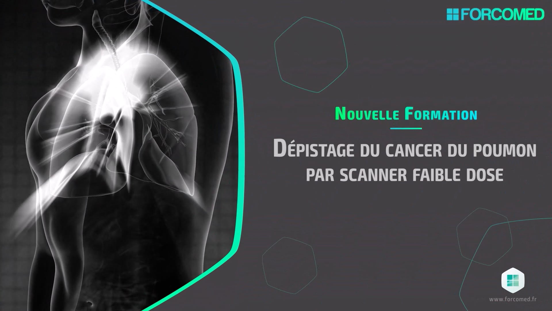 Forcomed - Formation au dépistage du cancer du poumon par scanner faible dose on Vimeo