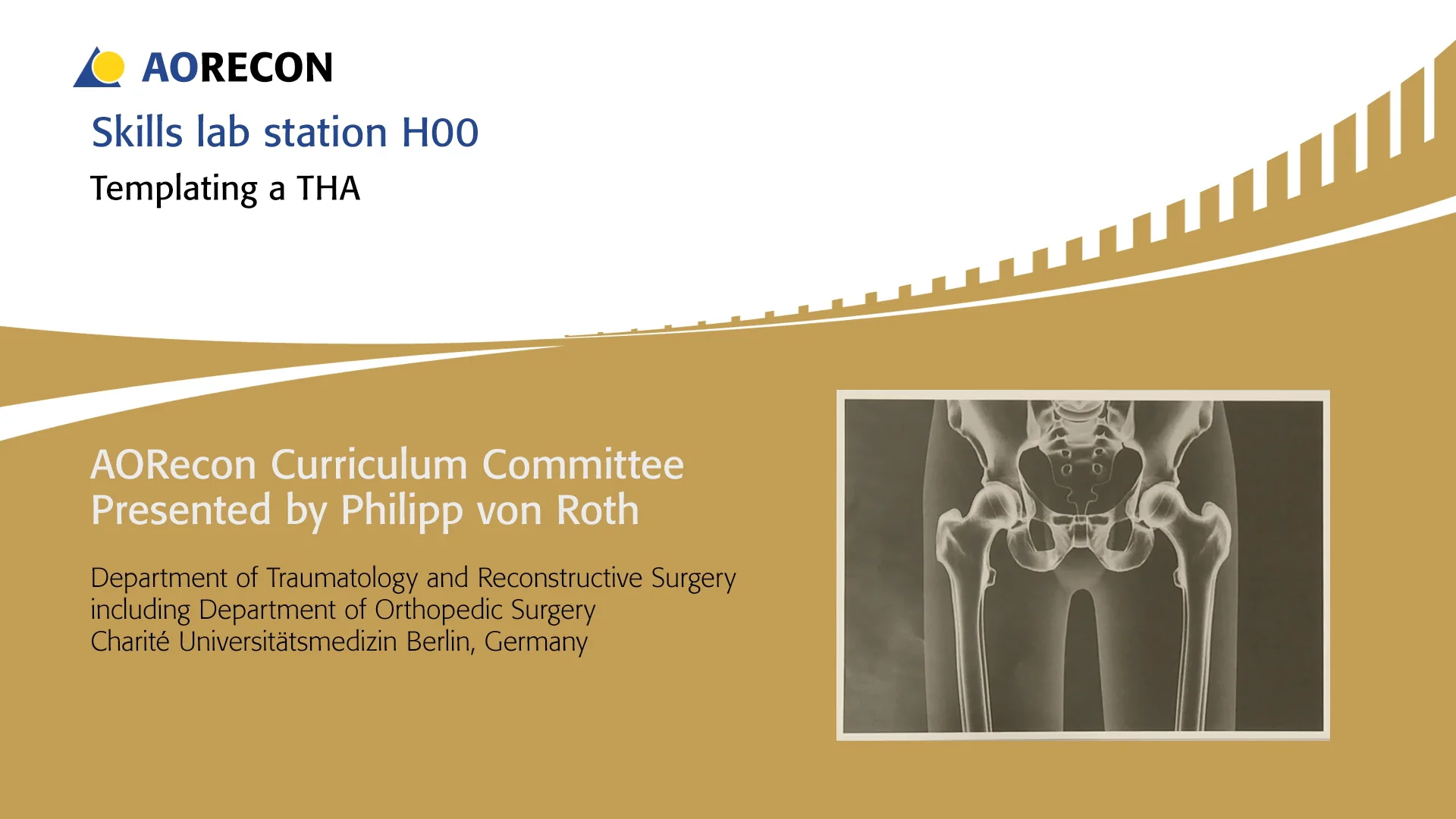 H00 – Templating a THA_faculty video