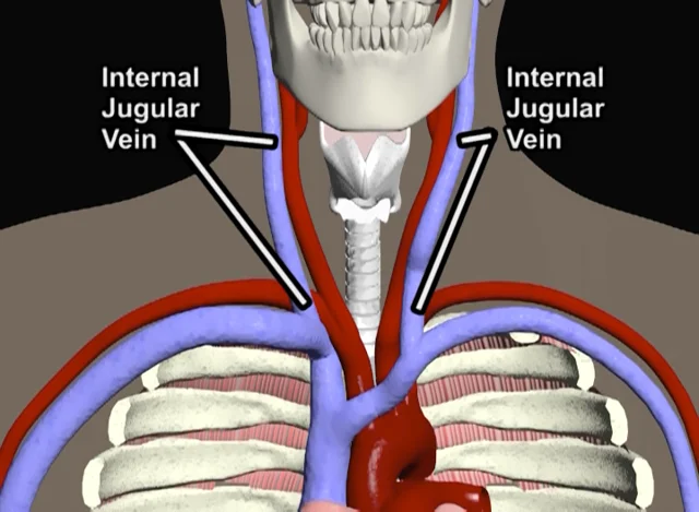 Ultrasound-Guided Central Line Placement Made Easy:, 46% OFF