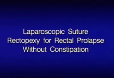 Laparoscopic Suture Rectopexy for Rectal Prolapse Without Constipation ...