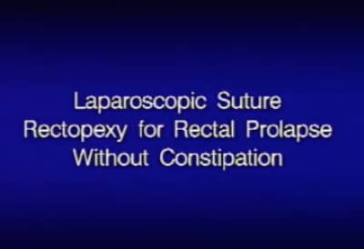 Laparoscopic Suture Rectopexy for Rectal Prolapse Without Constipation ...