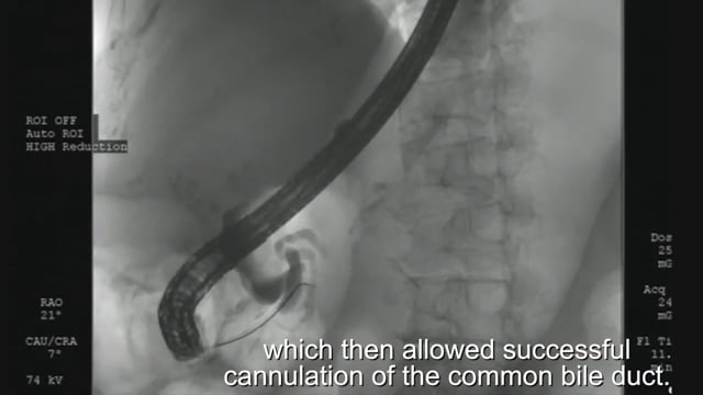 Gastroenterology Online Training Courses | EDUCARE