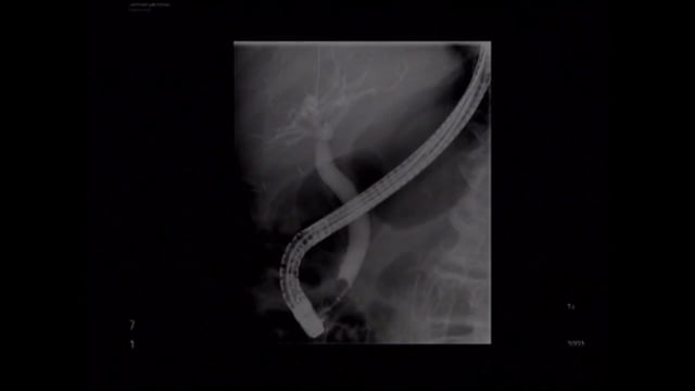 Gastroenterology Online Training Courses | EDUCARE