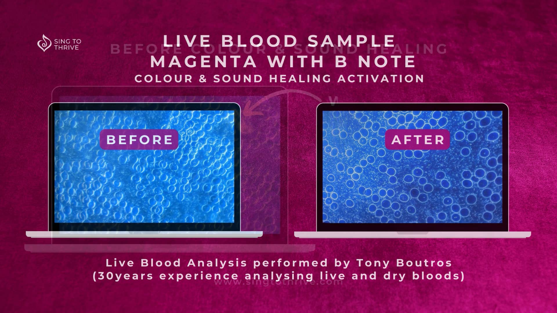 Live Blood Analysis-Magenta with B Note by Tony Boutros, March 2023 on Vimeo