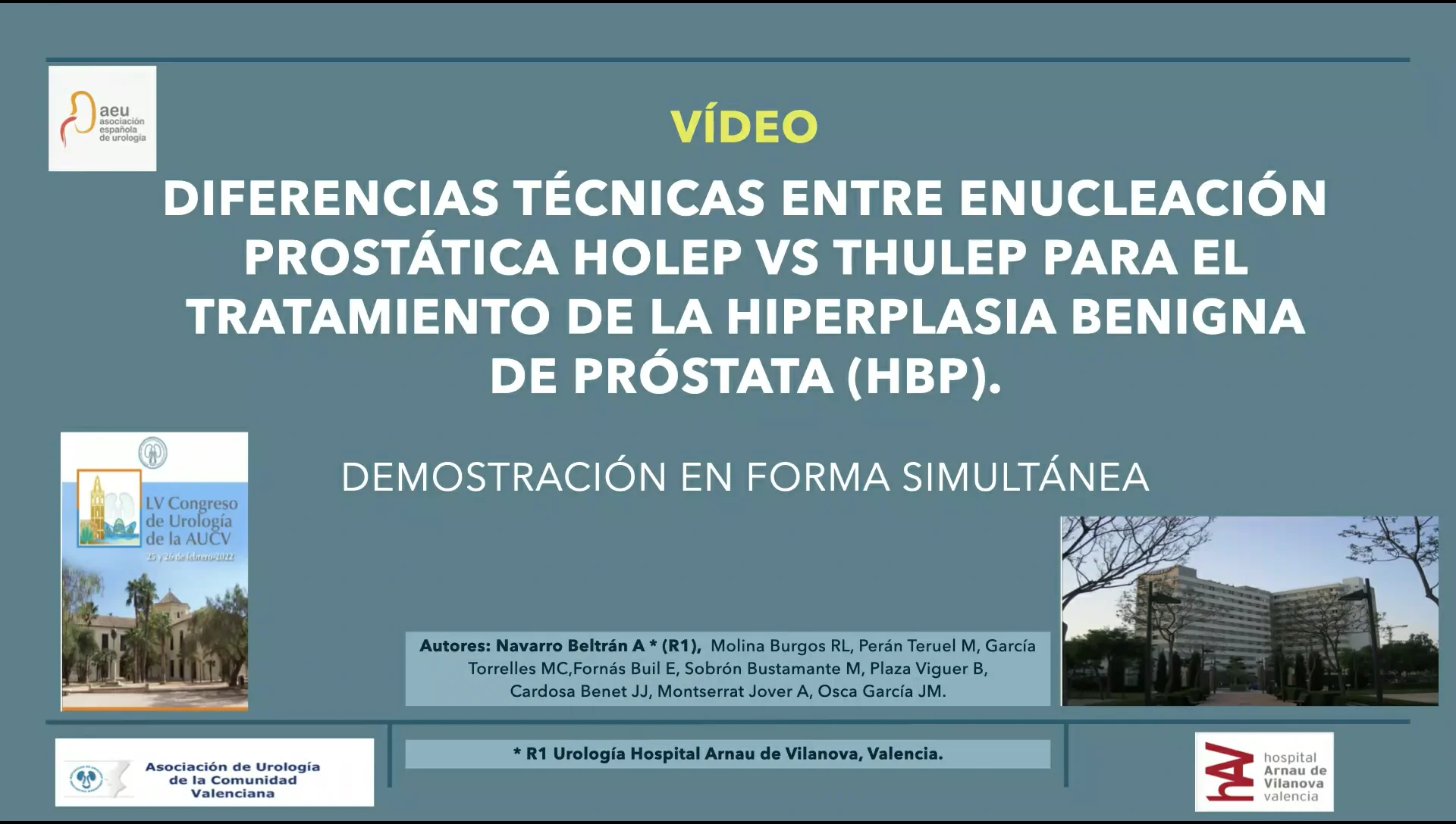 DIFERENCIAS TÉCNICAS ENTRE ENUCLEACIÓN PROSTÁTICA HoLEP VS ThuLEP PARA EL TRATAMIENTO DE LA HBP ...
