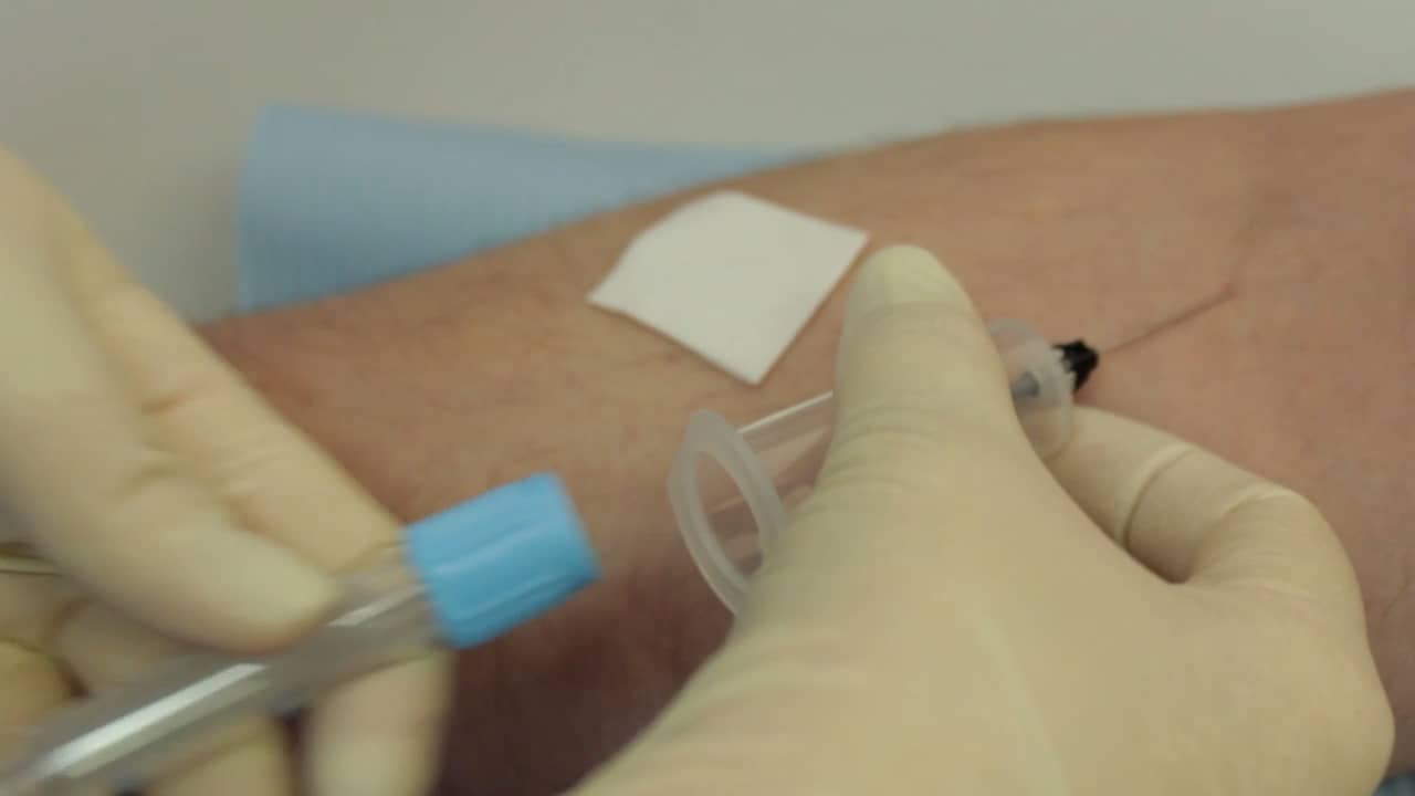 Straight needle blood draw on Vimeo