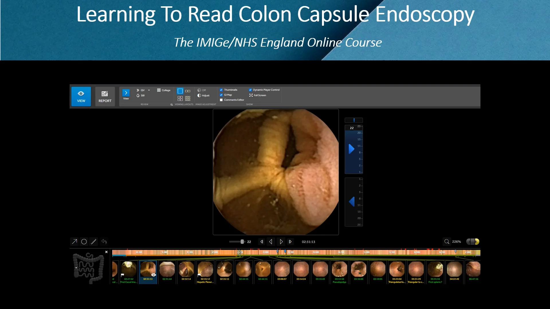 Web based capsule endoscopy training courses.mp4 on Vimeo
