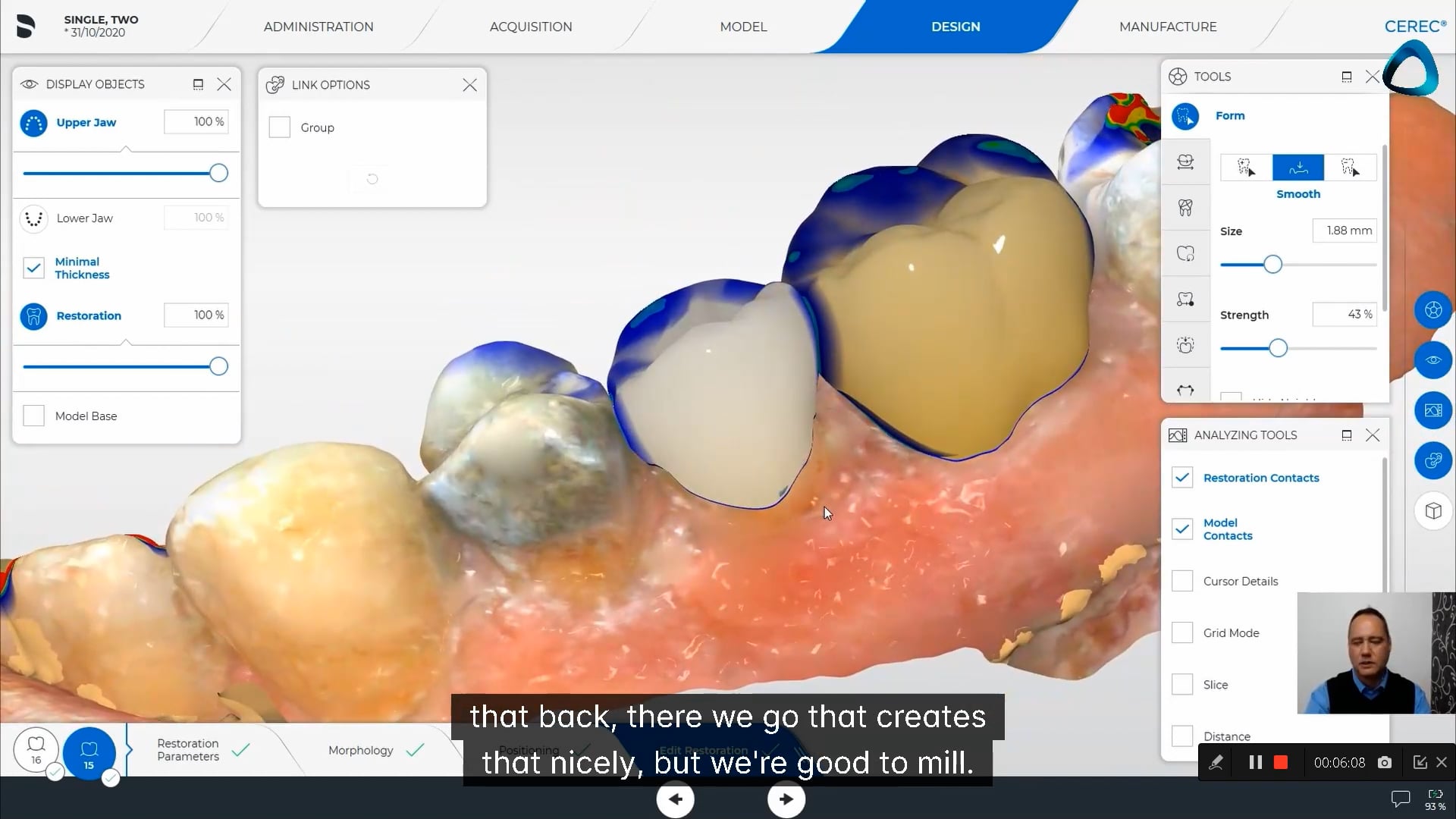 2- Designing two adjacent crowns on Vimeo