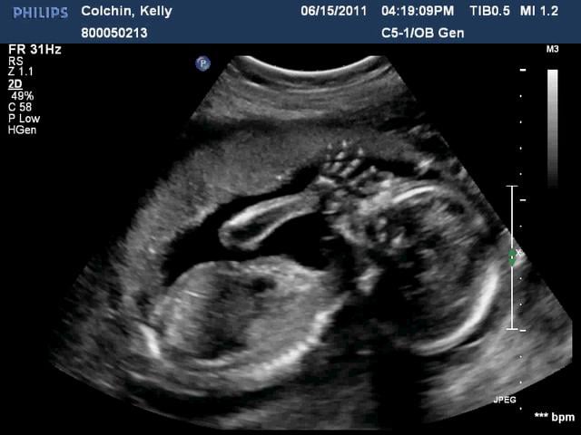 Baby Skaggs Thumbsucking! on Vimeo