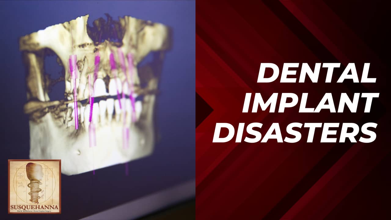 Dental Implant Disasters on Vimeo