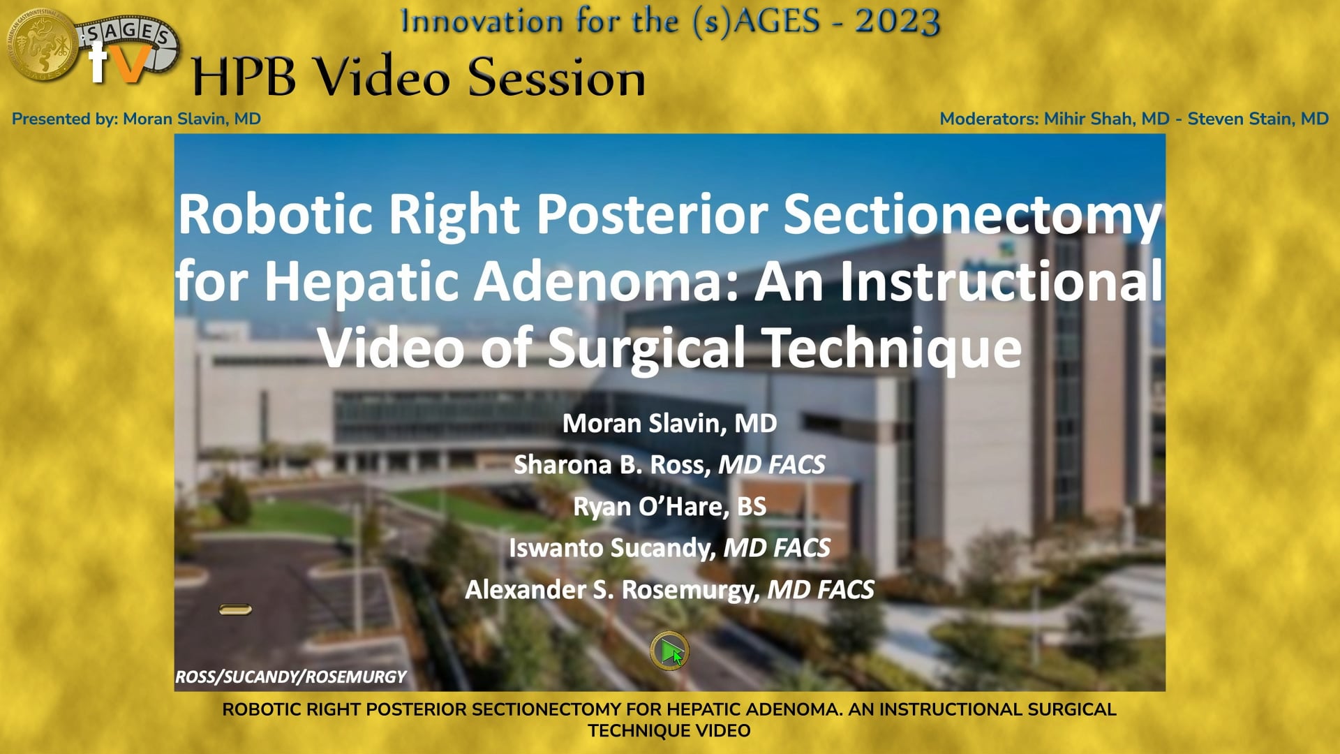 ROBOTIC RIGHT POSTERIOR SECTIONECTOMY FOR HEPATIC ADENOMA. AN ...