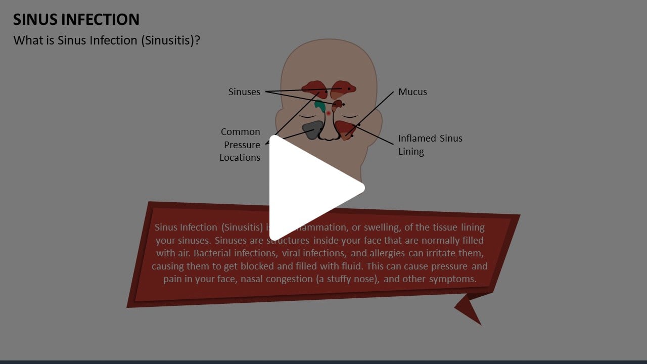Sinus Infection Animated Presentation - SketchBubble on Vimeo