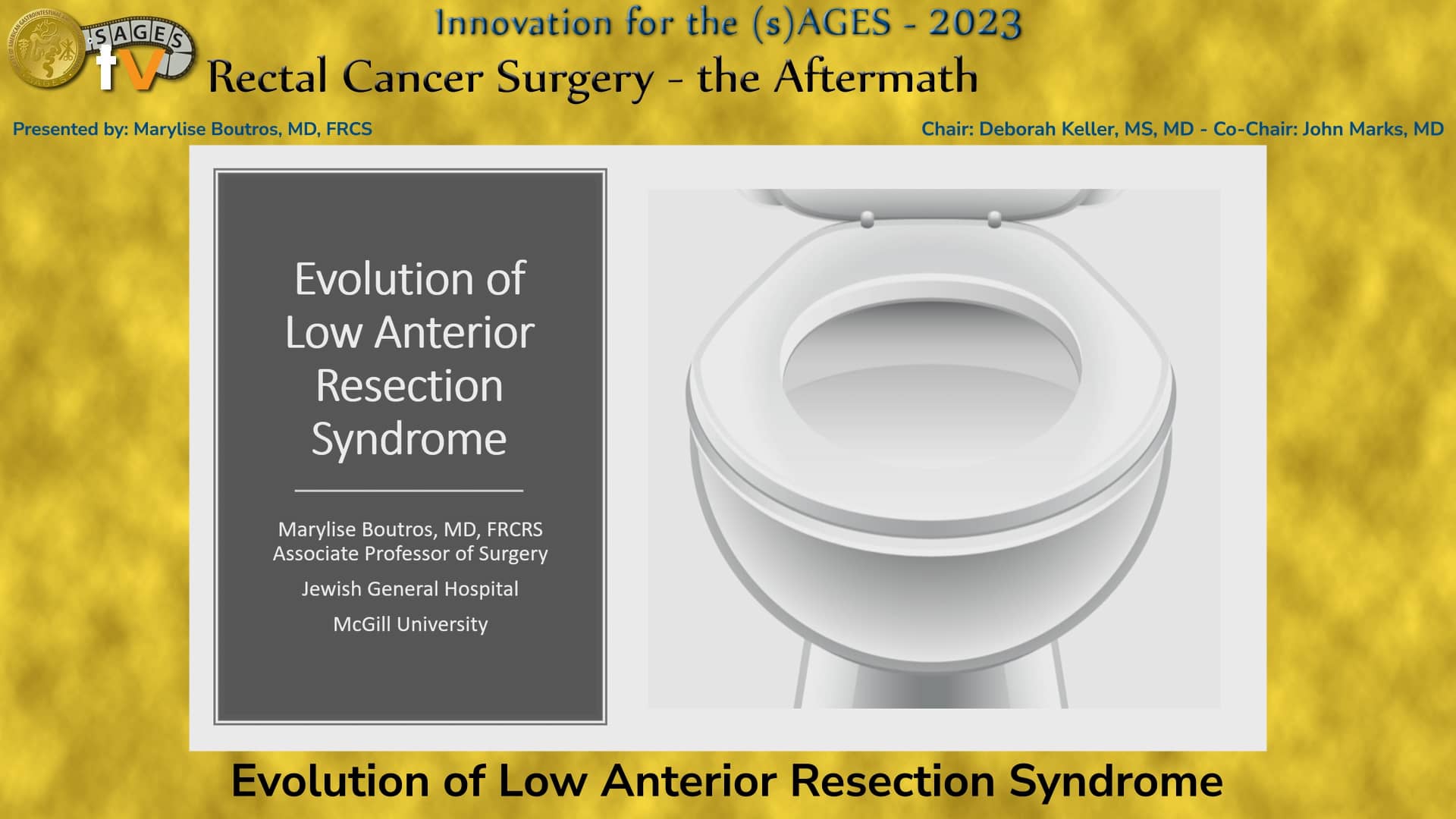 Evolution of Low Anterior Resection Syndrome on Vimeo