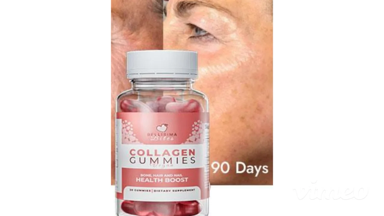 Bellisima Bites Collagen Gummies | Wrinkle Gummies : Your guide to ...