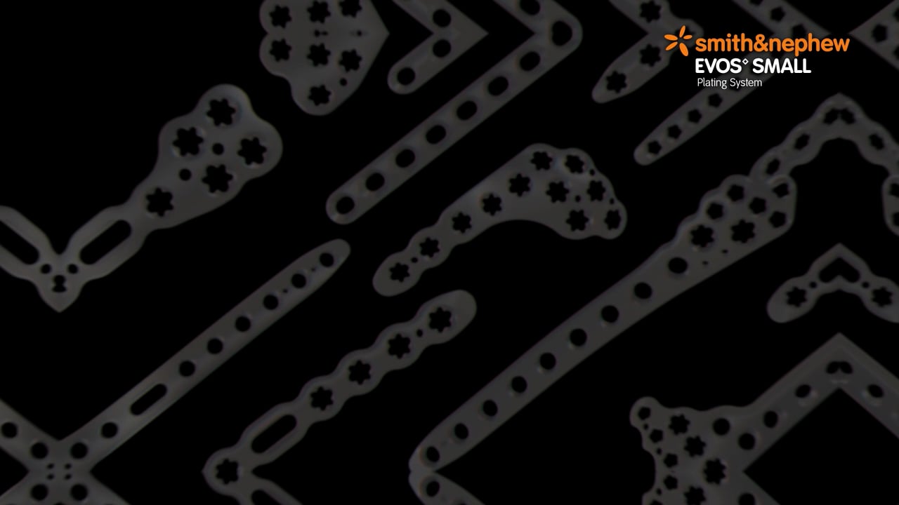 Evos Small - Placas - Legendado on Vimeo