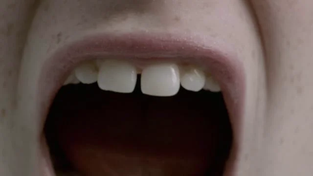 Sharpened Canine Teeth Tumblr