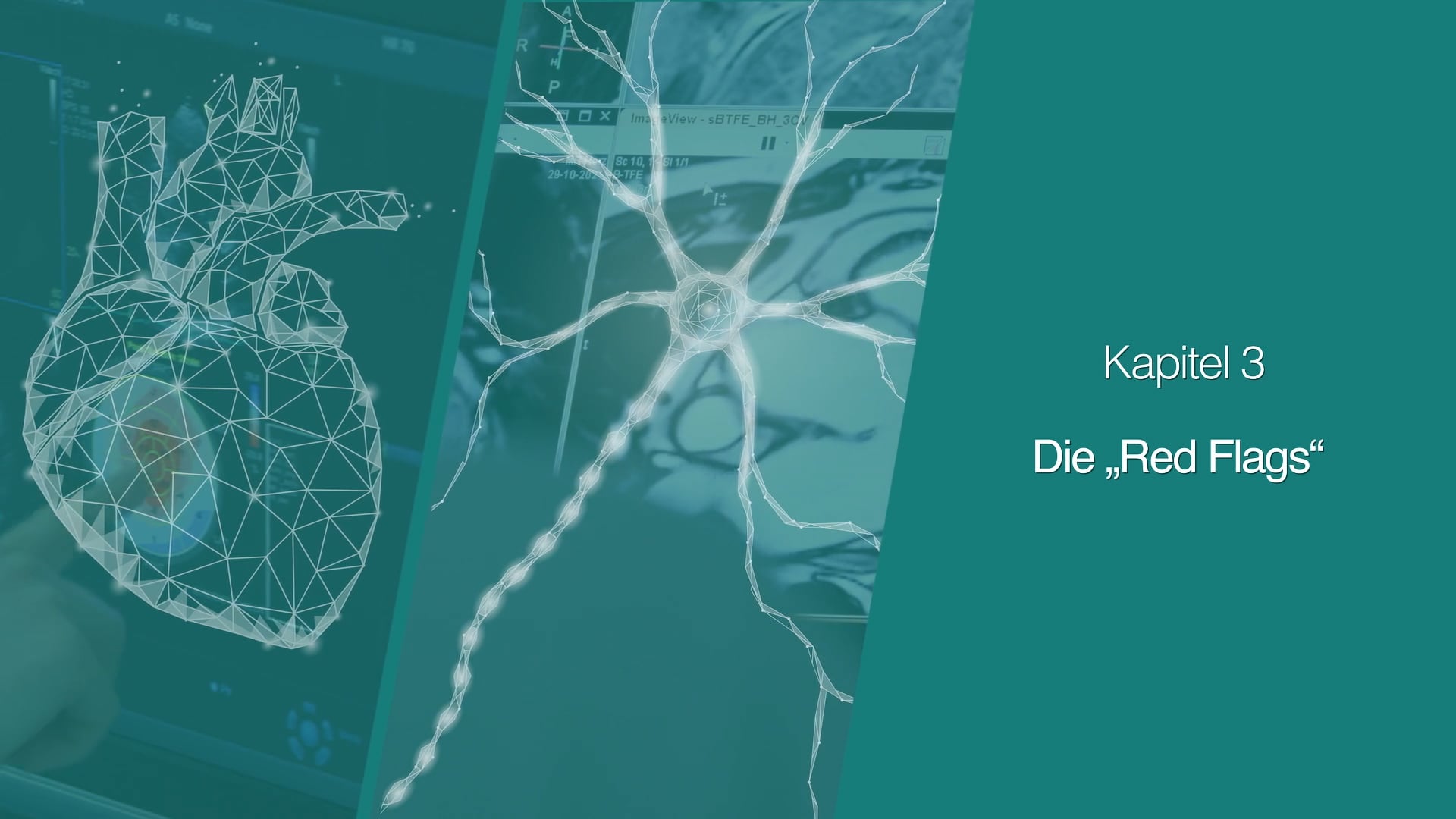 Red Flags der Transthyrethin-Amyloidose mit Kardiomyopathie | CME Video ...