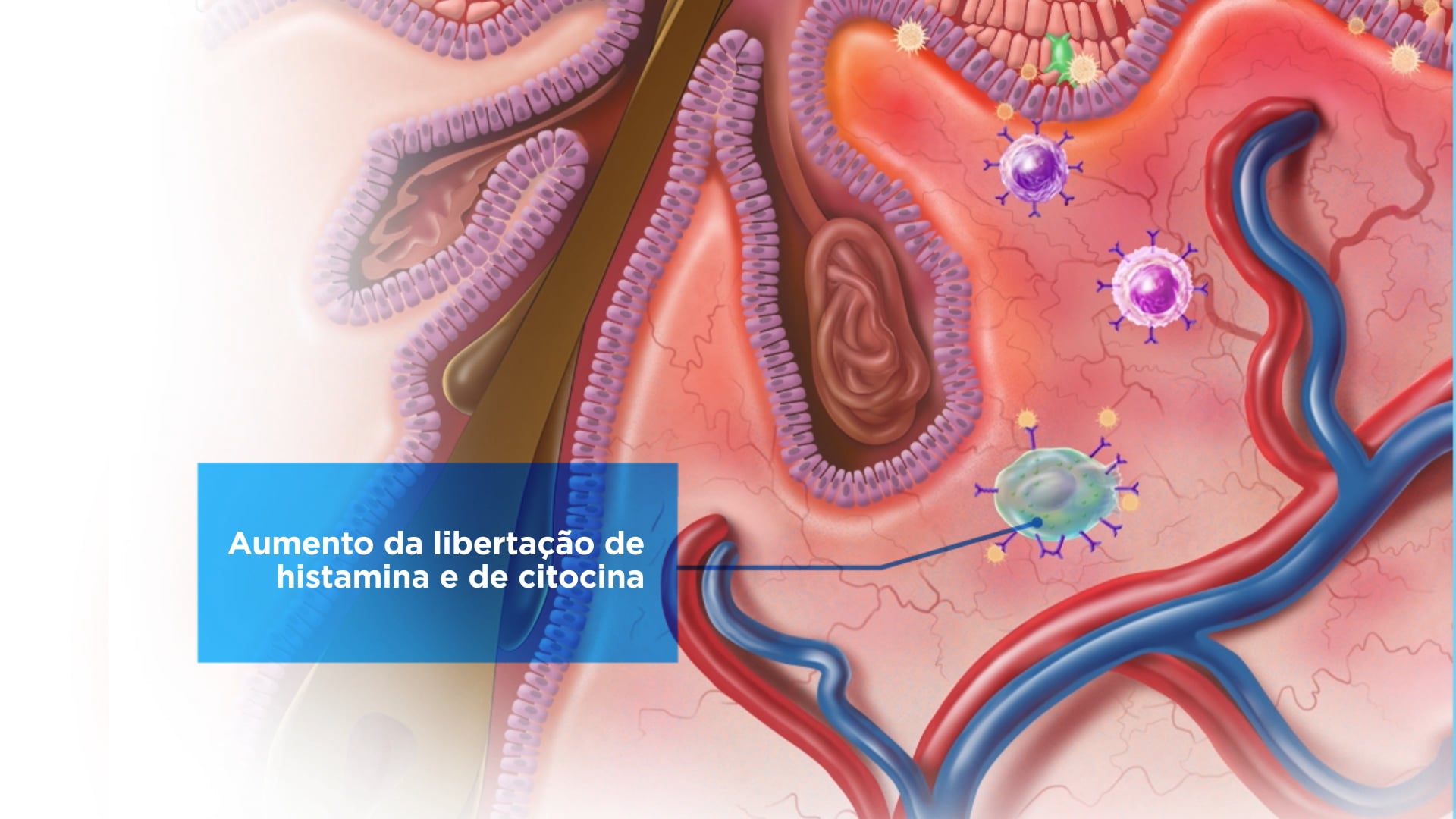 HLS_P230051_J0018_T01_Derm_Complete_MOA_videos_pt-PT_HD_1920x1080_23 on Vimeo