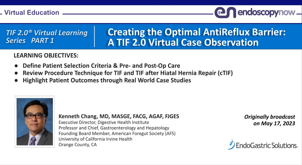 TIF 2.0 Virtual Learning Series PART-1 Creating the Optimal AntiReflux ...