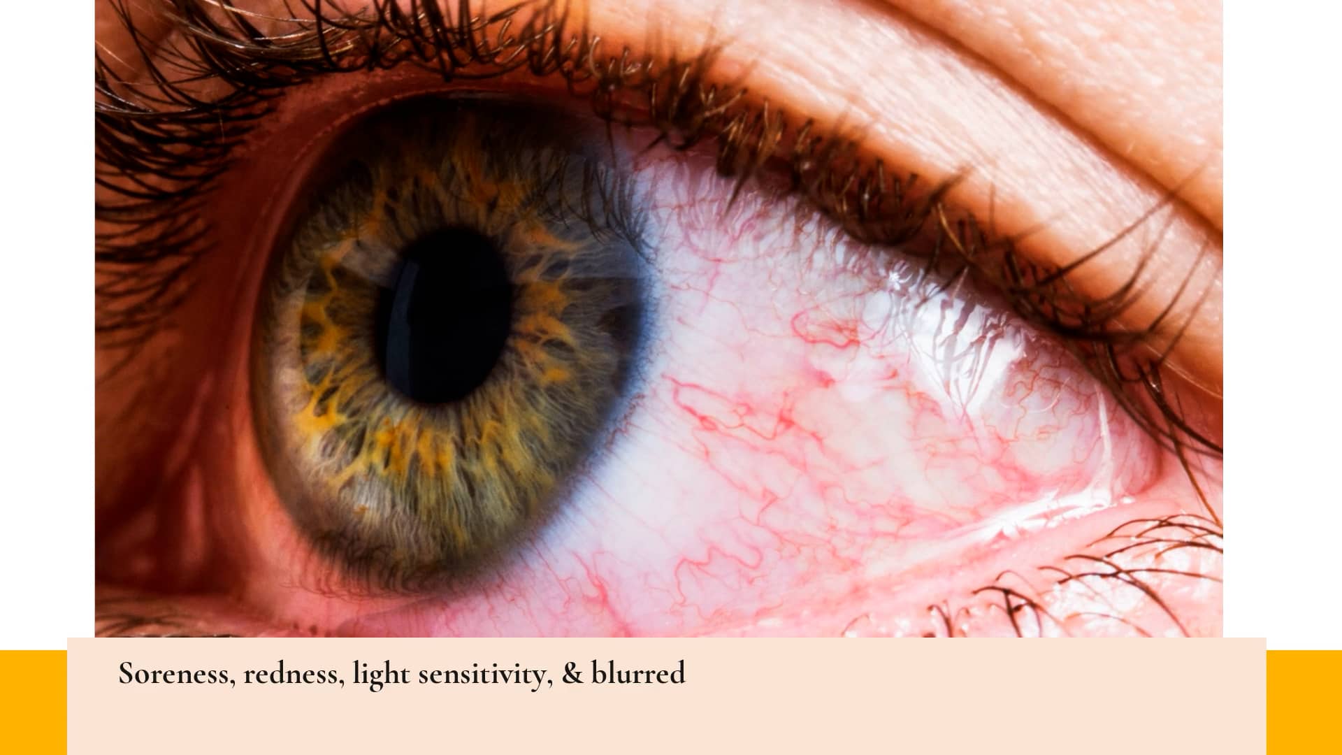 ERG Diagnostic Testing For Eye Strain & Neurological Optical Issues At ...