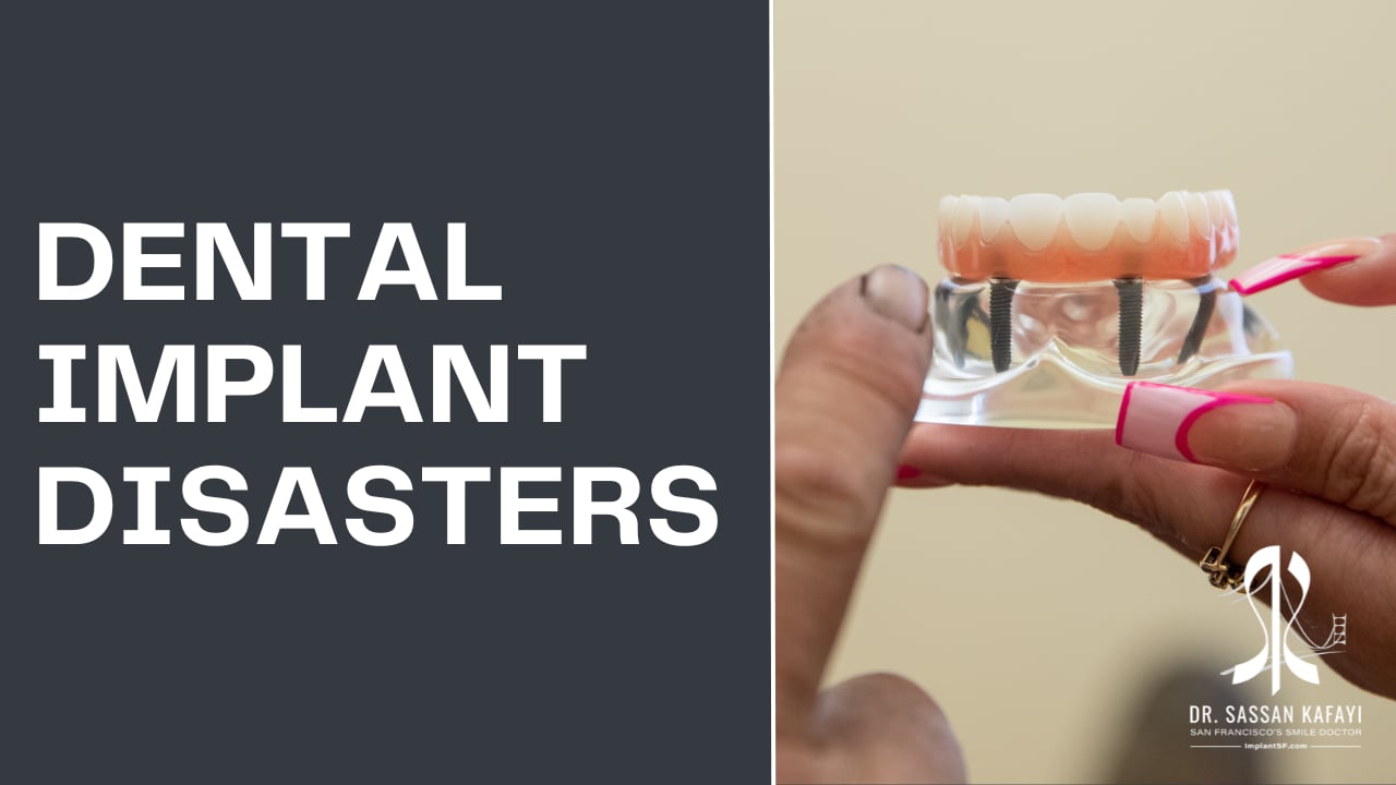 Dental Implant Disasters on Vimeo