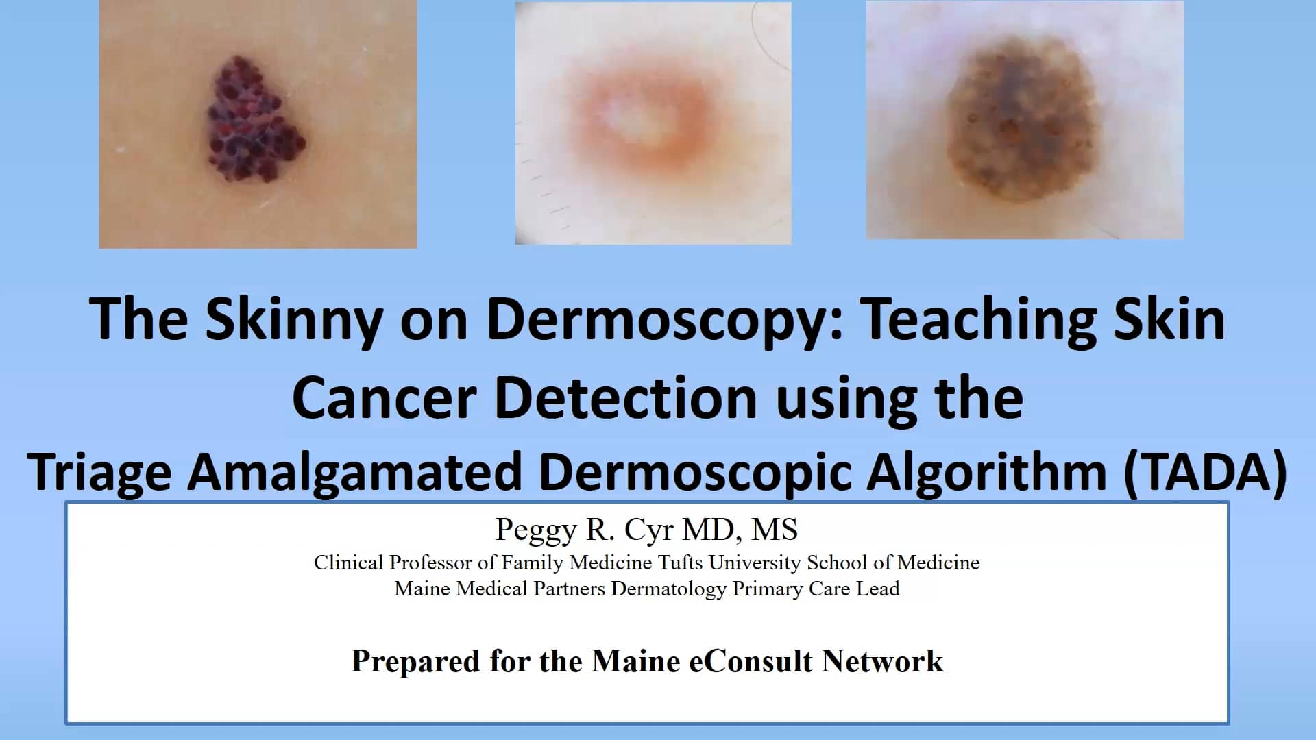 MEeCN Training: The Skinny on Dermoscopy on Vimeo