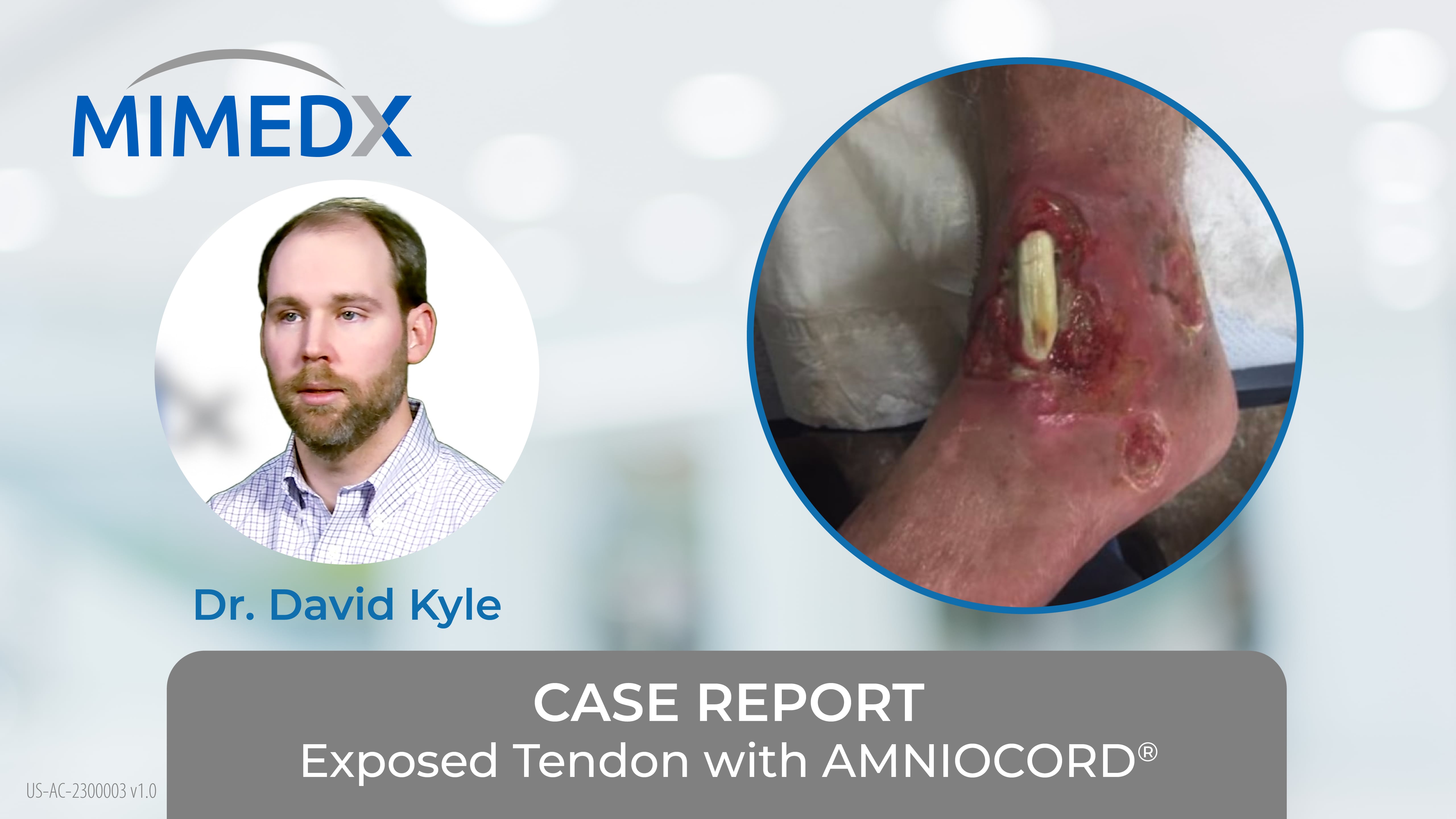 Dr. David Kyle, Exposed Tendon with AMNIOCORD® Case Report on Vimeo