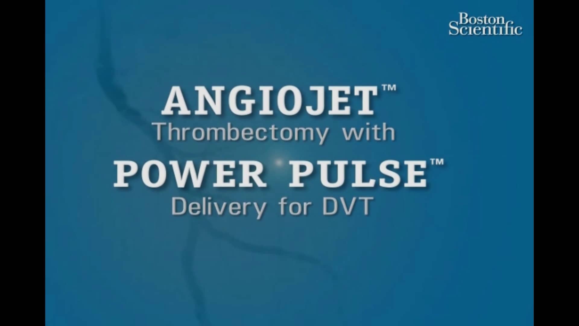 PI-1463003-AA AngioJet with Power Pulse Video ANZ on Vimeo