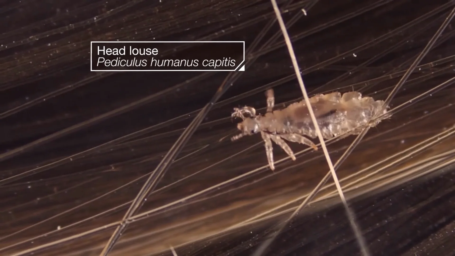 Lice Crawling in Hair on Vimeo