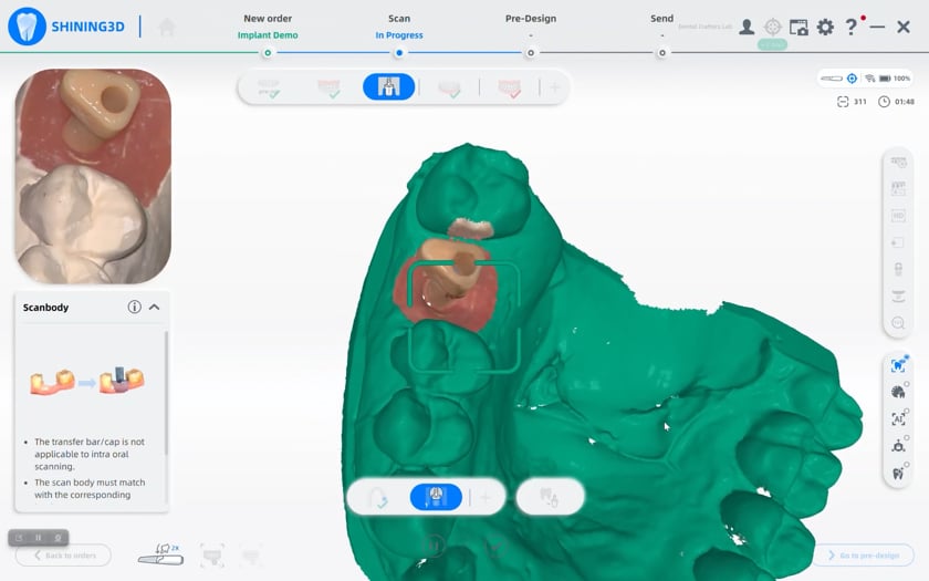 Shining Tutorial Videos - Dental Crafters