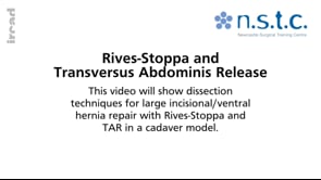 Basic anatomy of abdominal wall - Rives-Stoppa and transversus ...
