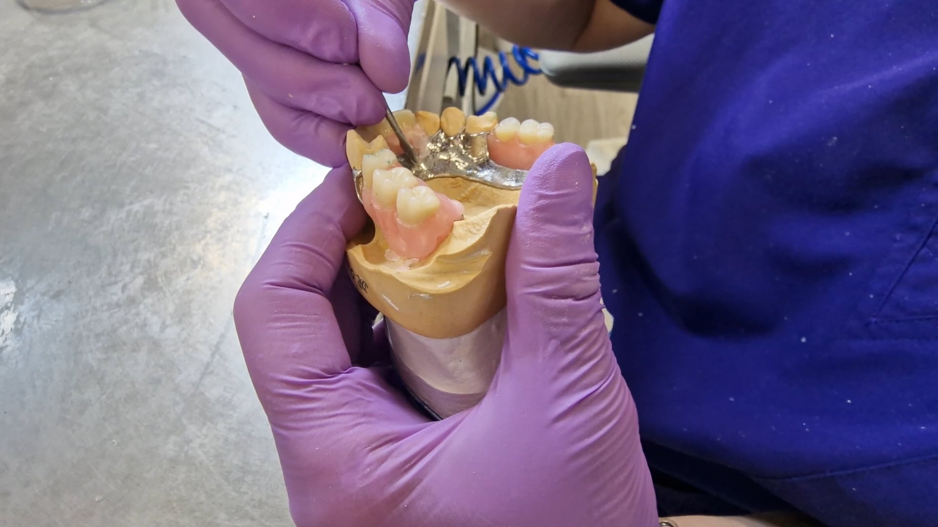 Dental Prosthetics and Denture Repairs - Marola Dental Laboratories