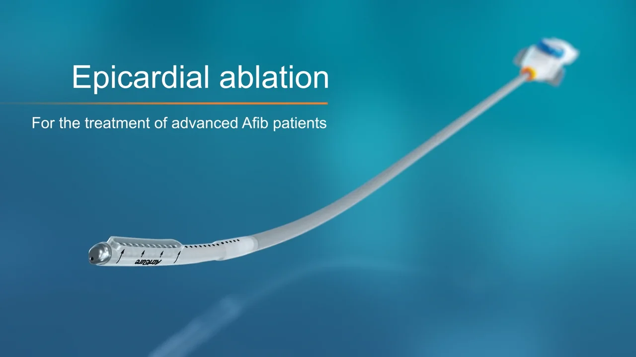 EPi-Sense ST™ Device