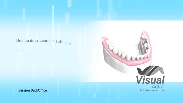 Inlay Onlay - TV Salle d'Attente Visual Activ' on Vimeo