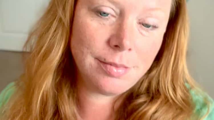 Gross Trauma Pictures