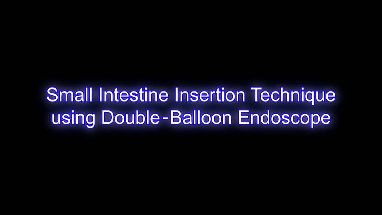 Small Intestine Insertion Technique using Double Balloon Endoscope ...