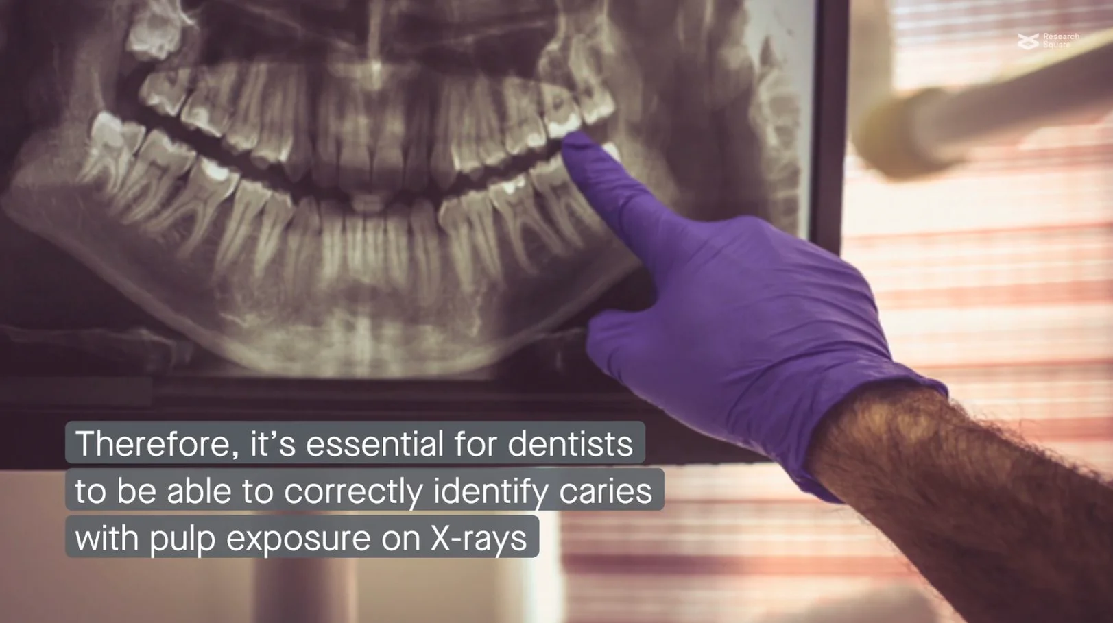 Artificial intelligence tool MSc outperforms dentists in diagnosing ...